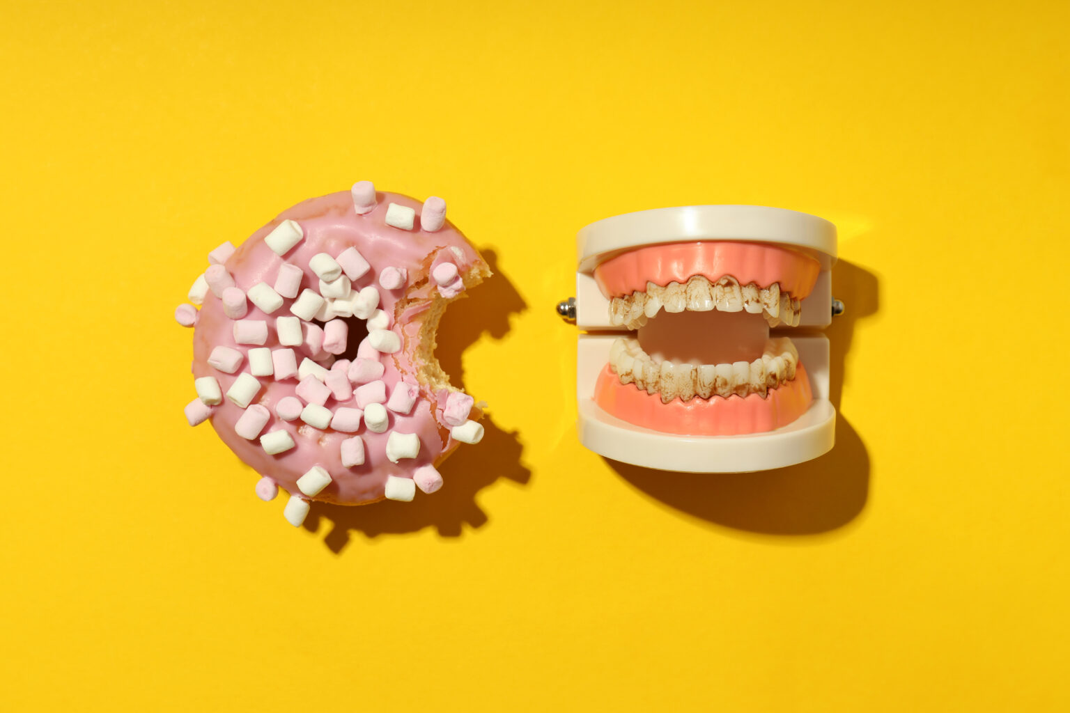 The Link Between Sugar and Tooth Decay | Trusted Dental Insight